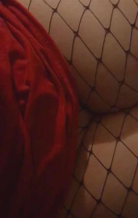 Dak Amputee Video 48