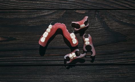 Immediate Dentures Understanding Bone Resorption During Healing