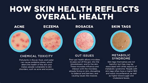 What Certain Skin Conditions May Indicate