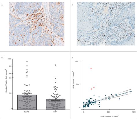 relationship between gitr and foxp3 expression in primary human tumors