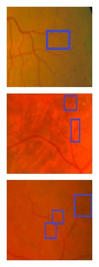 illustrative comparison between results obtained from manual observers