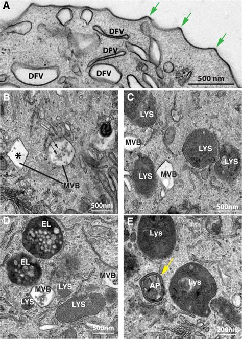 Age Related Endolysosome Dysfunction In The Rat Urothelium Pmc
