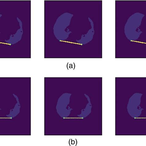 Example Of The Orientation Alignment Of The Subject Based On The Lung Mask Download