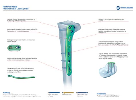 Proximal Tibia