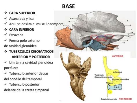 Hueso Temporal