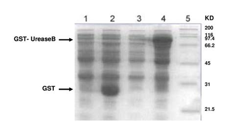 Sds Page Analysis Of Expression Of Pgex 4t 1 Urease B In E Coli 1 Download Scientific