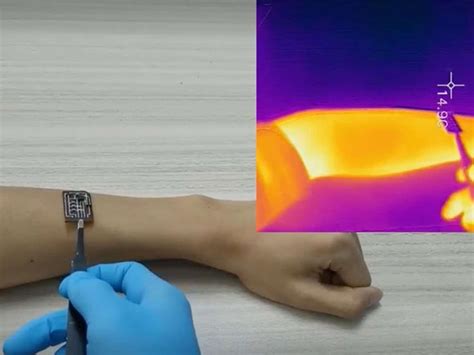 Temperature Responsive Medical Sensor With Self Healing Abilities And Skin Adaptability