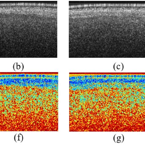 Oct Structural Uper Row And Boct Contrast Images Lower Row After 24 Download Scientific