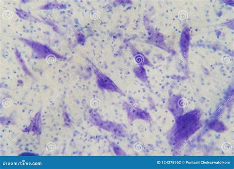 Neurons Cells From The Brain Under The Microscope View Stock Photo Image Of Electron Axon