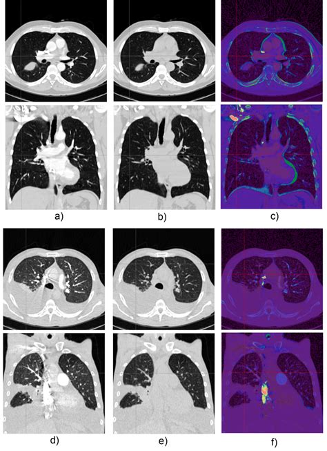 Sample Slices From Data Sets B Top Two Rows And C Bottom Two Download Scientific Diagram