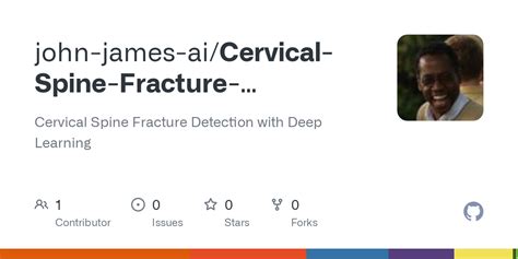 cervical spine fracture detection de
