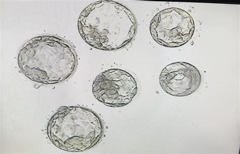 Mask Detection Instance Segmentation Dataset And Pre Trained Model By Class