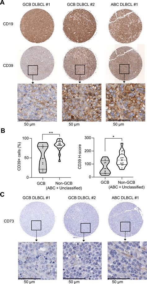 The Expression Status Of Cd39 And Cd73 Ectonucleotidases In Dlbcl Download Scientific Diagram