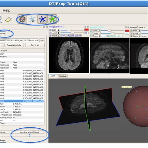 Head Motion Artifacts Rigid Registration Parameters Between Each Download Scientific Diagram