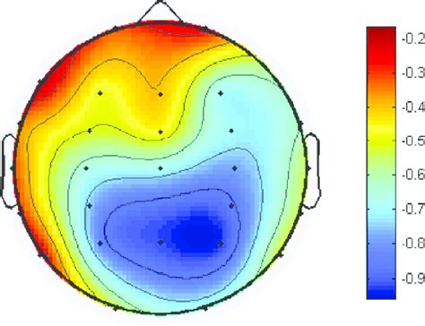 Spline Interpolated Isovoltage Map Of The Subtraction Of 2nd Word Erps