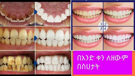 በአንድ ቀን ለዛውም በስሀታት Youtube