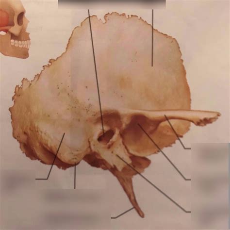 Week Figure The Temporal Bone Diagram Quizlet