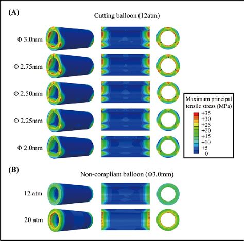 Figure 1 From Finite Element Analysis Of The Cutting Balloon With An
