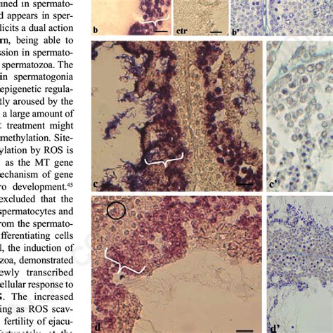 Abcd Mt Mrna Localization In Testis Of Natural And Estrogen Exposed Download Scientific
