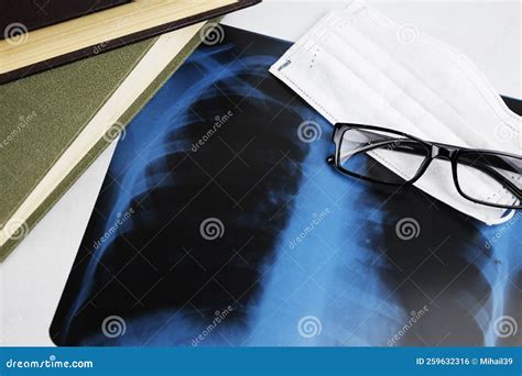 X Ray Of The Lungs X Ray Film Of The Patient Medical Concept Stock