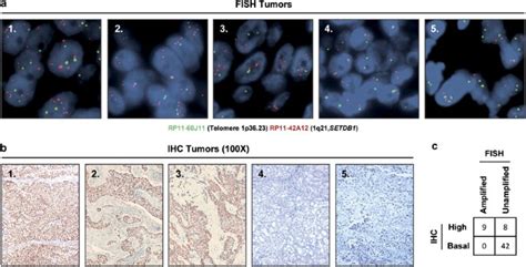 Gene Amplification Of The Histone Methyltransferase Setdb1 Contributes To Human Lung