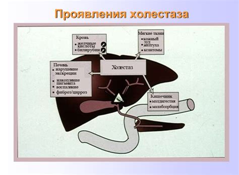Холестаз при беременности - презентация онлайн