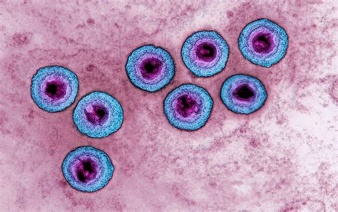 Speedx Sexually Transmitted Infections Portfolio