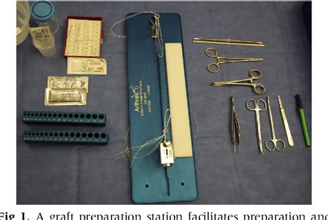 Figure 1 From The 8 Strand Hamstring Autograft In Anterior Cruciate Ligament Reconstruction