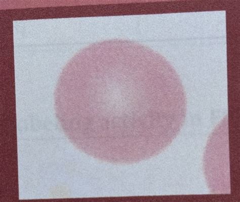 Blood Lab Flashcards Quizlet