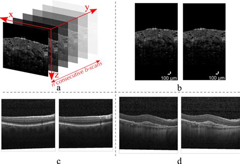 Schematic Of An Oct Volume With Examples Of Consecutive Slices Download Scientific Diagram Schematic Of An Oct Volume With Examples Of Consecutive Slices Download Scientific Diagram