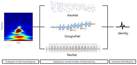 Sensors | Free Full-Text | Intelligent Deep Models Based on Scalograms of Electrocardiogram ...