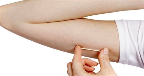 Nexplanon Insertion Care Nexplanon Yluy