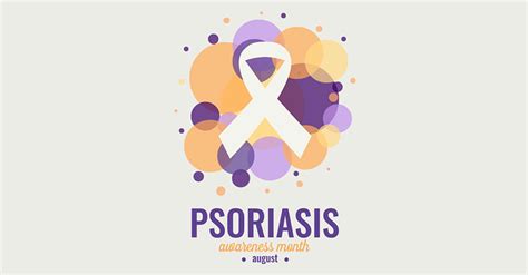 5 Psoriasis Triggers And How To Handle Flare Ups Nmami Life
