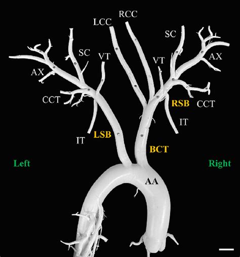 Pdf Morphology Of Aortic Arch Branching Patterns In The Eurasian