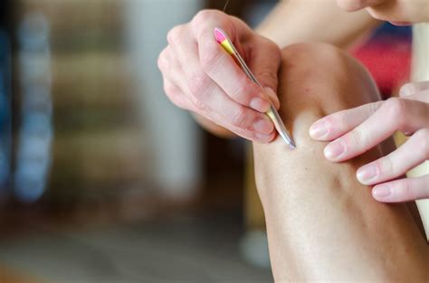 How To Treat Ingrown Hairs Ewmoda