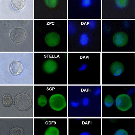 Morphology Of Epithelial Cells In Follicular Fluid A Epithelial