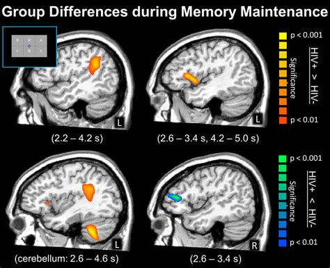 Group Oscillatory Differences During Working Memory Maintenance