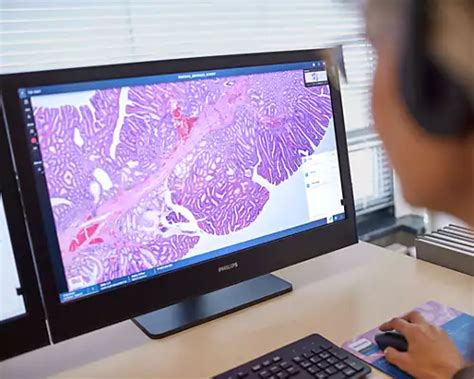 Dicom In Digital Pathology Philips