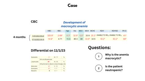 Case Macrocytosis The Blood Project
