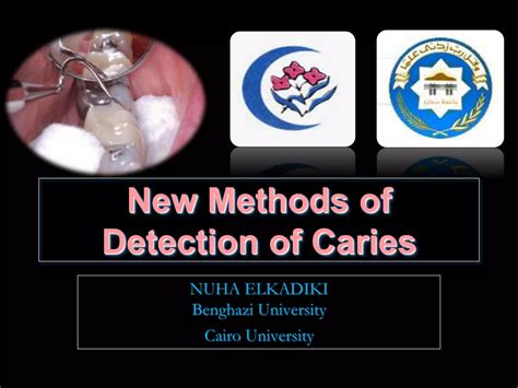 Advance Method In Detection Of Dental Caries Copy Ppt