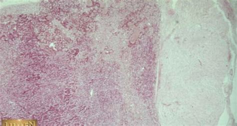 Endocrine Lab Quiz Flashcards Quizlet