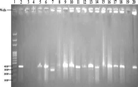 Agarose Gel Of The Dna Fragment Of Amplified Pcr Of Anopheles Gambiae Download Scientific