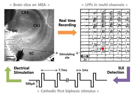 Figure 1 From Prediction Of The Seizure Suppression Effect By