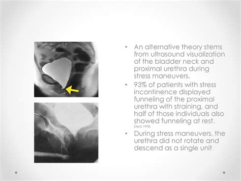 Definition Classification And Triage Of Female UI Ppt Download