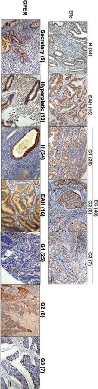 Ep623 Sex Hormonal Profile During The Development From Endometrial