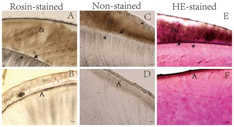 An Improved Method For Preparing Stained Ground Teeth Sections Peerj