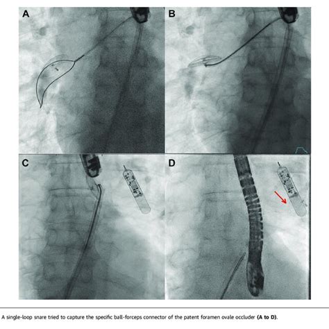 Standard Retrieval Strategy Download Scientific Diagram