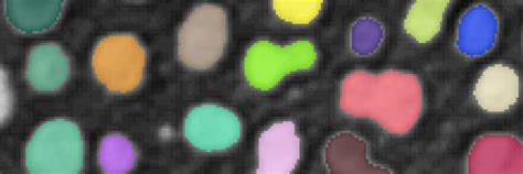 ️ Image Segmentation — The Image Analysis Field Guide ️ Image Segmentation — The Image Analysis Field Guide
