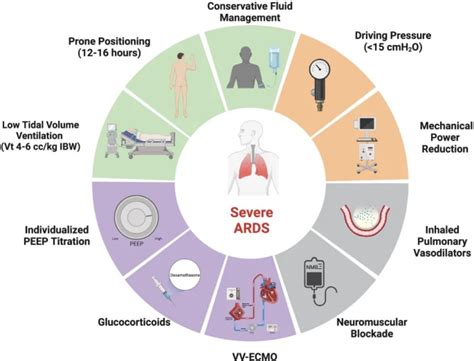 Kimberly Smith Rrt Nps On Linkedin Ards Treatment Strategies Not