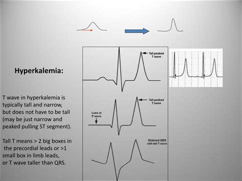 Ppt Hyperkalemia Causes And Implications Powerpoint Presentation